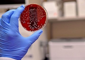 Importance Of Microbiology| In Nursing,Agriculture,Pharmacy