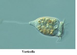 Examples Of Protozoa With Detailed Characters & Pictures