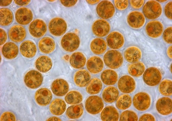 7 Types Of Algae Based On Their Characters And Size